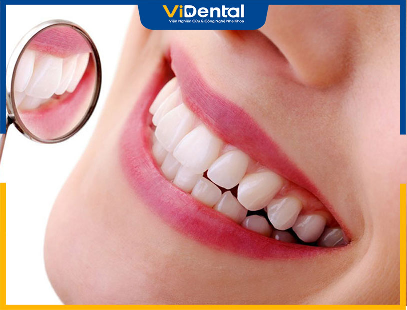 Răng Sứ Của Đức: 6 Loại Chất Lượng Và Chi Phí Chi Tiết