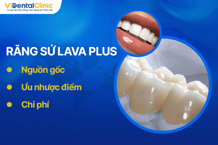 Răng Sứ Lava Plus Có Tốt Không? Giá Bao Nhiêu?